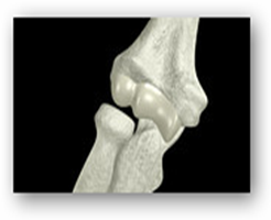 Amgen Gets FDA Approval for Prolia – Treatment for Post Menopausal ...